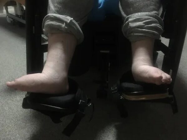 7 Mobility Aids That Will Support Your Foot Care Needs | Disability ...