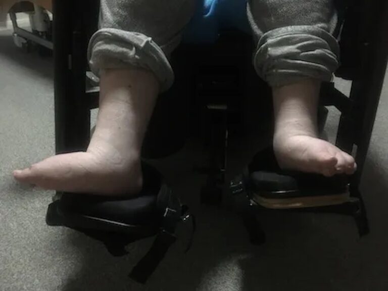 7 Mobility Aids That Will Support Your Foot Care Needs | Disability ...